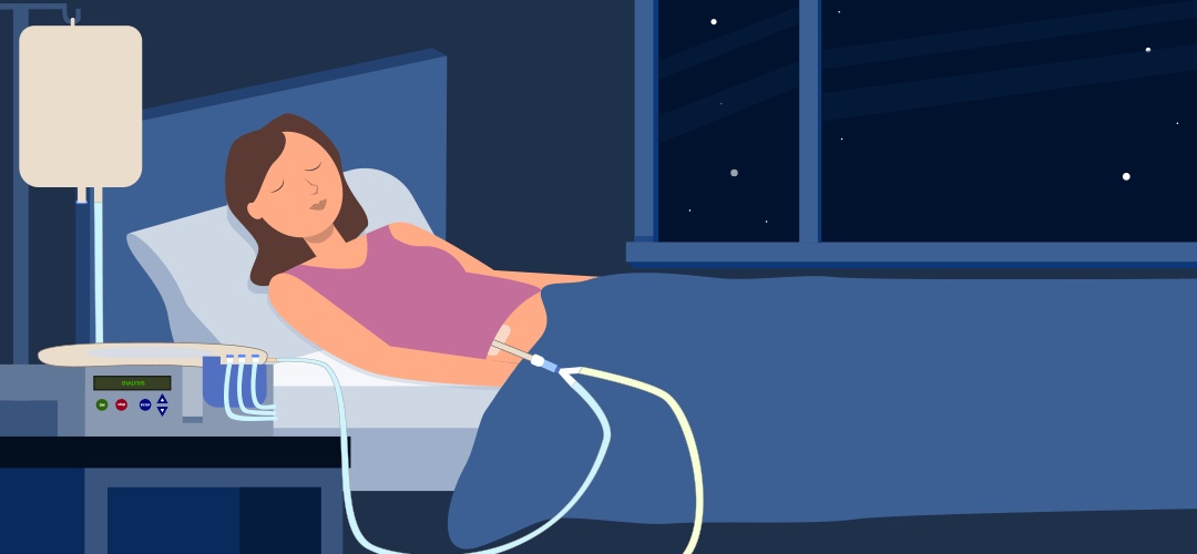 Entenda os benefícios da Diálise Peritoneal Automática - Clinirim