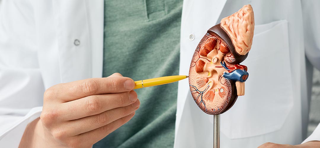 Entenda quais são as principais doenças renais crônicas e saiba como ...