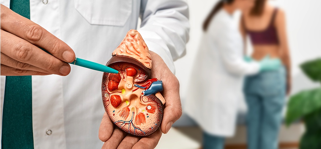 O que são doenças renais e quais são as mais comuns? - Clinirim