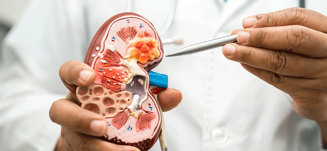 Como saber quando os rins não estão funcionando bem? - Clinirim