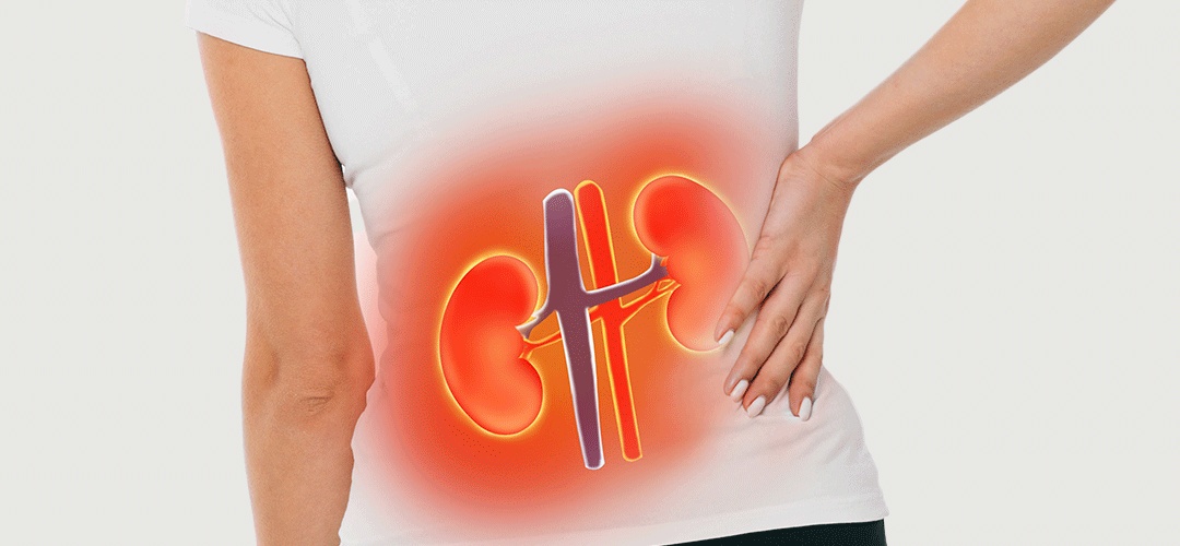 Quais são os sinais e sintomas de insuficiência renal? - Clinirim