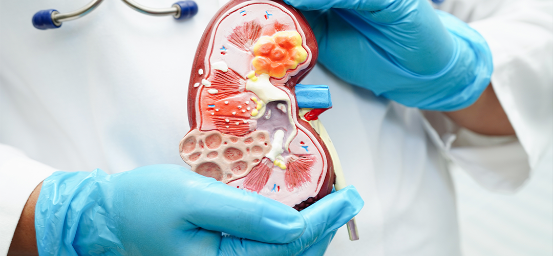 Tratamento interdisciplinar para doenças renais crônicas - Clinirim